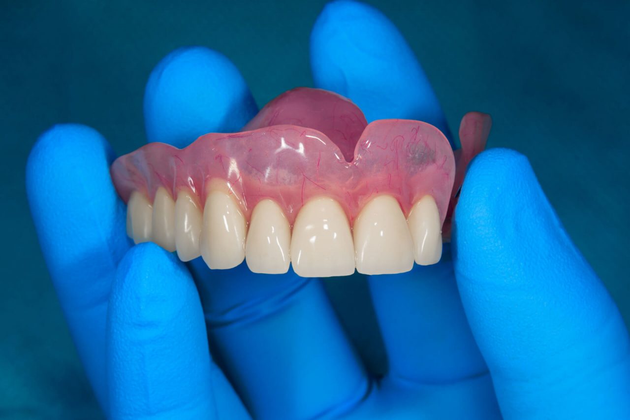 Proteze dentare Sopron Ungaria - Molnar Dental